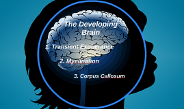 Transient Exuberance by hannah yale on Prezi