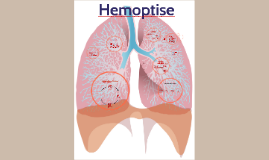 Hemoptise by Gabi Couto on Prezi