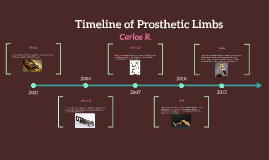 Timeline of Prosthetic Limbs by Carlos _ on Prezi