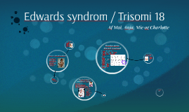 Edwards syndrom / Trisomi 18 by Charlotte Andreasen on Prezi