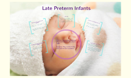 Late Preterm Infant by Kandace Fischer on Prezi