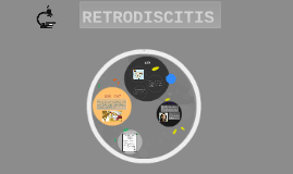 Retrodiscitis by jael maldonado on Prezi