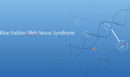 Blue Rubber Bleb Nevus Syndrome by Colleen Murphy on Prezi