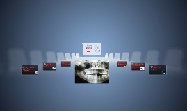 Dr. Otto Walkhoff by Jennifer Pittenger on Prezi