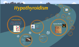 Hypothyroidism Concept Map by Rebecca Digangi on Prezi