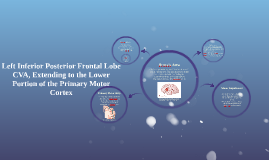 Ossicular Chain Discontinuity by McKayla Burgess on Prezi