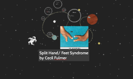 Split Hand Syndrome by Cecil Fulmer on Prezi