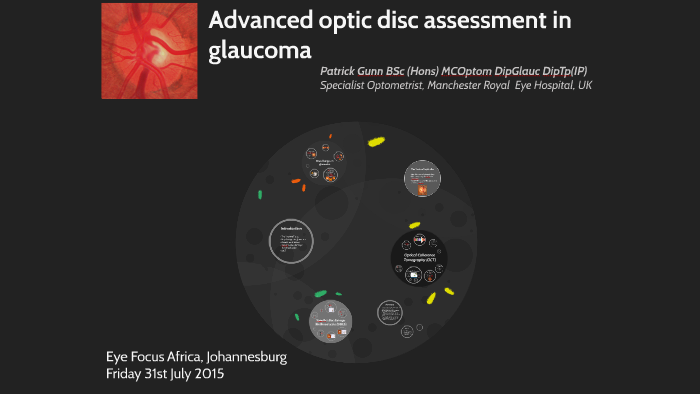 Advanced optic disc in glaucoma, Eye Focus Africa by Patrick Gunn on Prezi