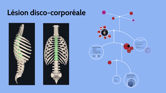 Lésion disco-corporéale by Maude Leblanc on Prezi