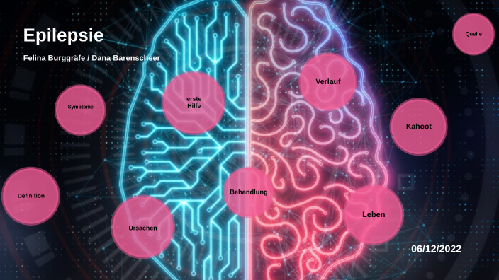 Epilepsie by Dana Barenscheer on Prezi