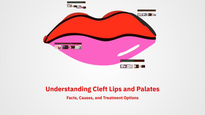 Understanding Cleft Lips and Palates by kenslea fickett on Prezi