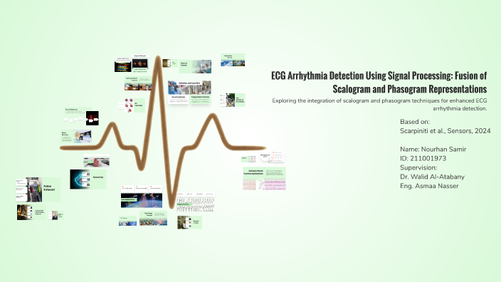 ECG Arrhythmia Detection Using Signal Processing: Fusion of Scalogram ...