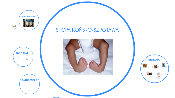 STOPA KOŃSKO-SZPOTAWA WRODZOMA by Emilia Chodubska on Prezi