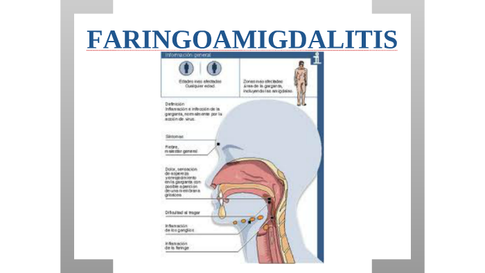 Faringoamigdalitis Aguda by Elias Córdova on Prezi