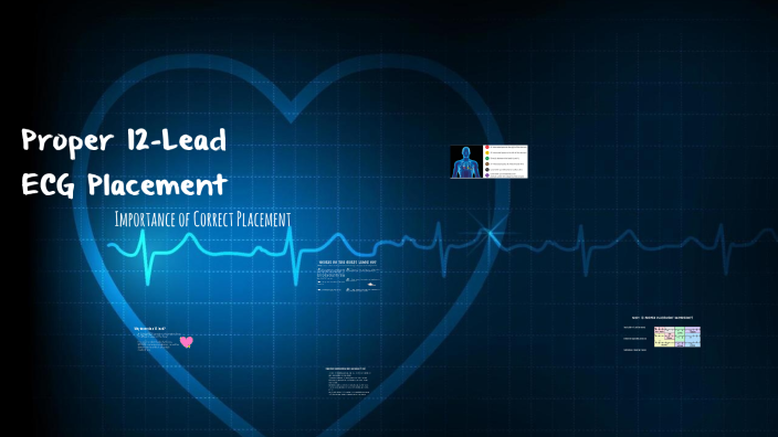 12 Lead ECG Placement by Erin Nickell on Prezi