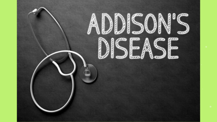 Addison's Disease by Kaylee Rucker on Prezi