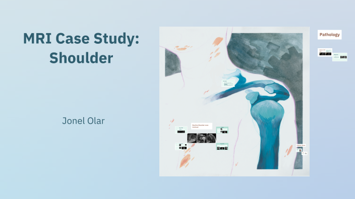 MRI Case Study: Shoulder Examination by William Grey on Prezi