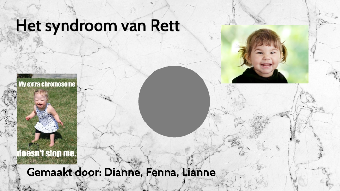 presentatie syndroom van Rett by Lianne Burghout on Prezi