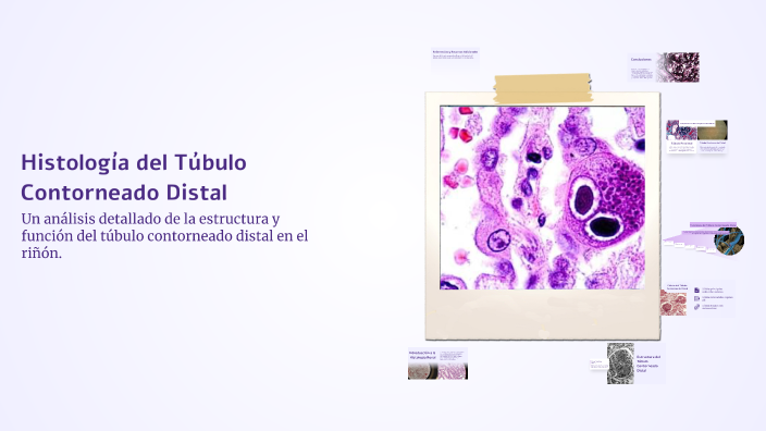 Histología del Túbulo Contorneado Distal by Ito ytm_iii89 on Prezi