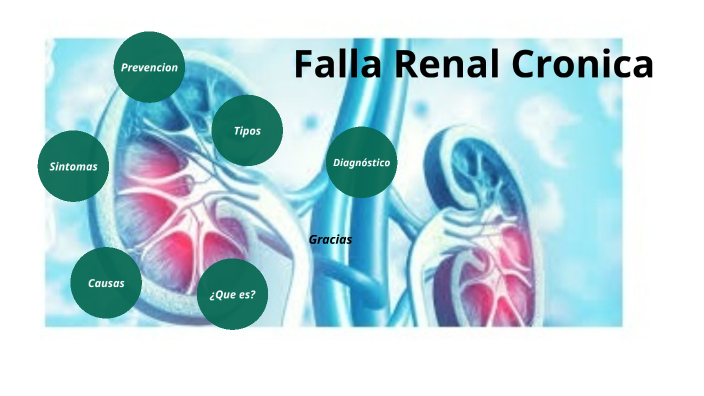 Falla renal cronica by Samuel DeJesus Aleman Garcia on Prezi