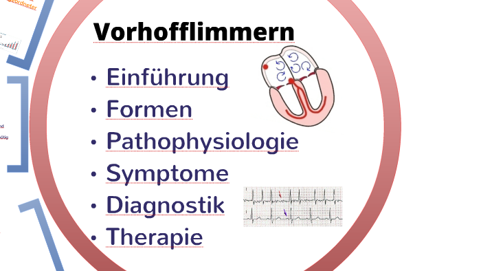 Vorhofflimmern by Patrick W on Prezi