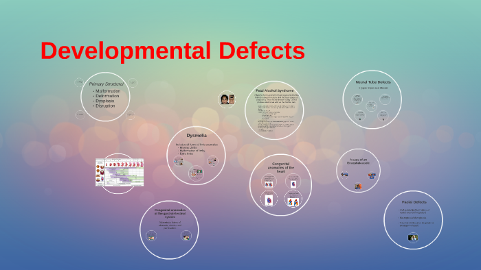 Developmental Defects by Simon Byatt on Prezi