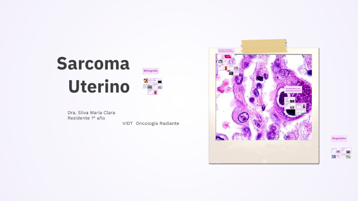 Sarcoma Uterino by Maria Clara Silva on Prezi