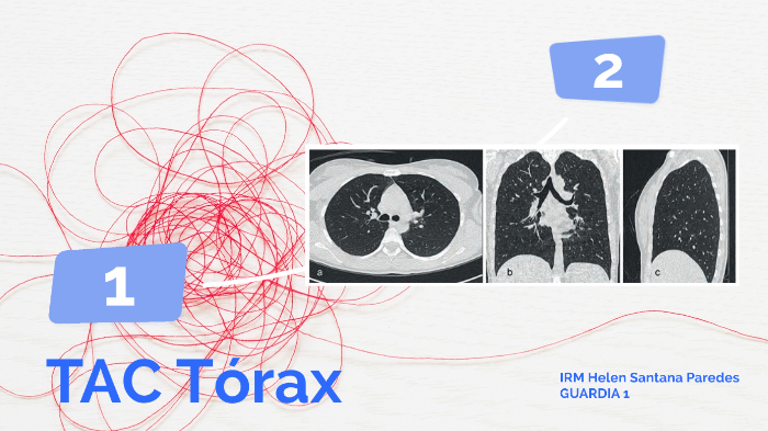 TAC torax Normal Y patologica by HELEN LISSETTE SANTANA PAREDES on Prezi