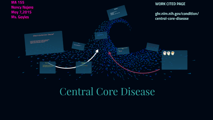 Central Core Disease by Jennifer Tierrafria