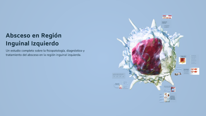 Absceso en Región Inguinal Izquierdo by ever amutari destre on Prezi