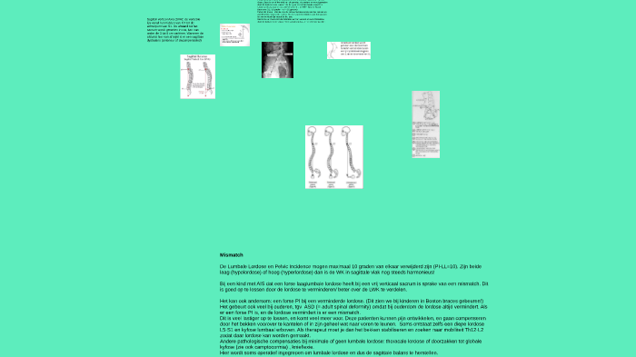 Sosort Lyon Pelvic parameters by Marijke Stuiver on Prezi