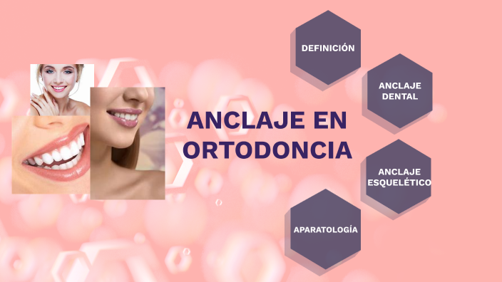 ANCLAJE EN ORTODONCIA by Abel Noe Olea Galvez on Prezi