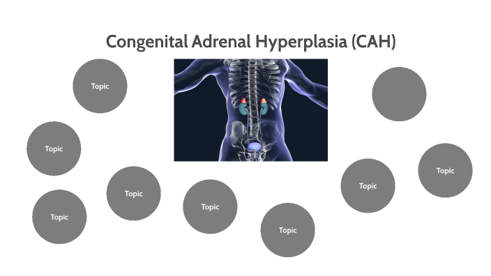 Congenital Adrenal Hyperplasia Cah By Sara Rostami