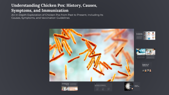 Understanding Chicken Pox: History, Causes, Symptoms, and Immunization ...