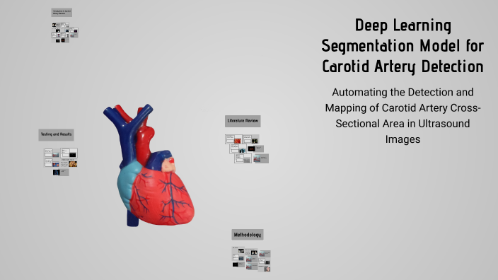 Deep Learning Segmentation Model for Carotid Artery Detection by Razan ...