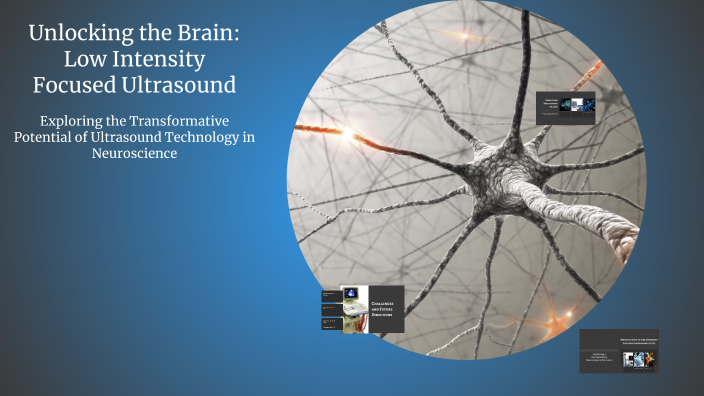 Unlocking the Brain: Low Intensity Focused Ultrasound by Kristin ...