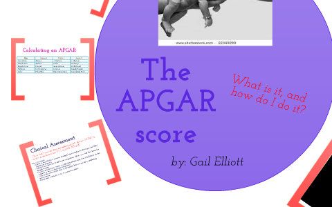 APGAR-Scoring a new baby by Gail Elliott on Prezi