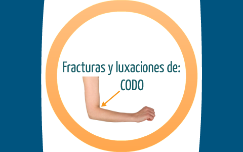 Fracturas y luxaciones de codo by Neguib Farah