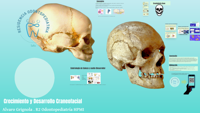 Crecimiento y Desarrollo Craneofacial: Relación con Maloclusiones by ...