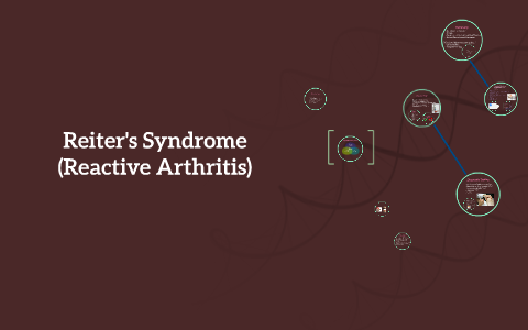Reiter's Syndrome by Cynthia Villalobos on Prezi