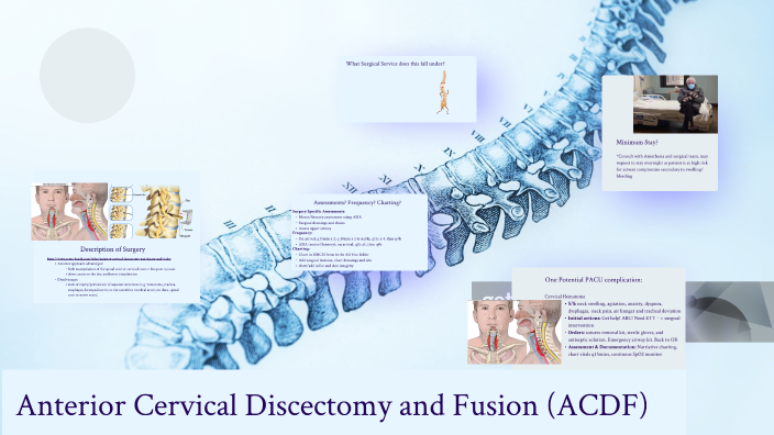 Anterior Cervical Discectomy and Fusion (ACDF) by Gina Ma on Prezi