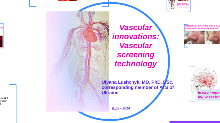 Vascular innovations: Vascular screening technology by Ulyana Lushchyk ...