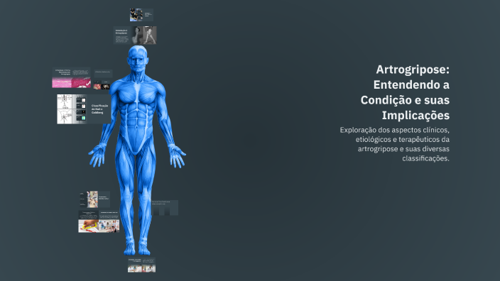 Artrogripose: Entendendo a Condição e suas Implicações by Ilizarov ...