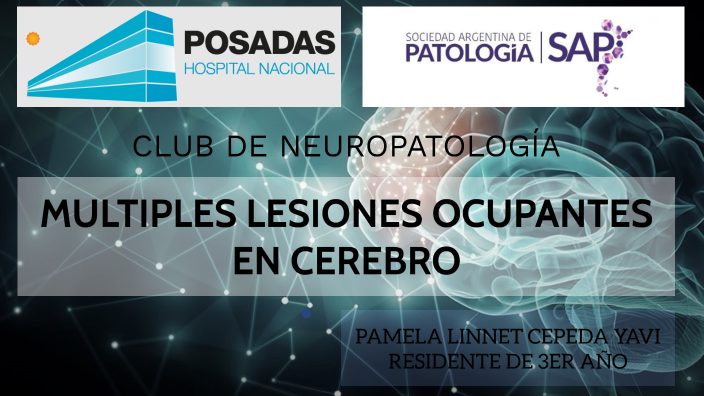 SAP club neuro by pamela cepeda yavi on Prezi