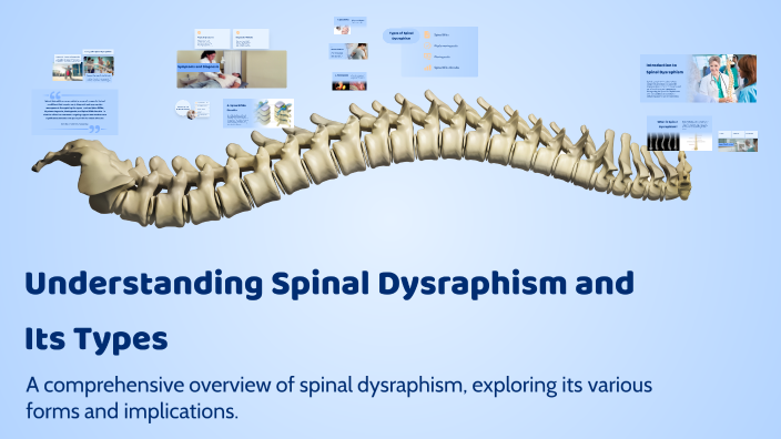 Understanding Spinal Dysraphism and Its Types by HAMNA AQIB on Prezi