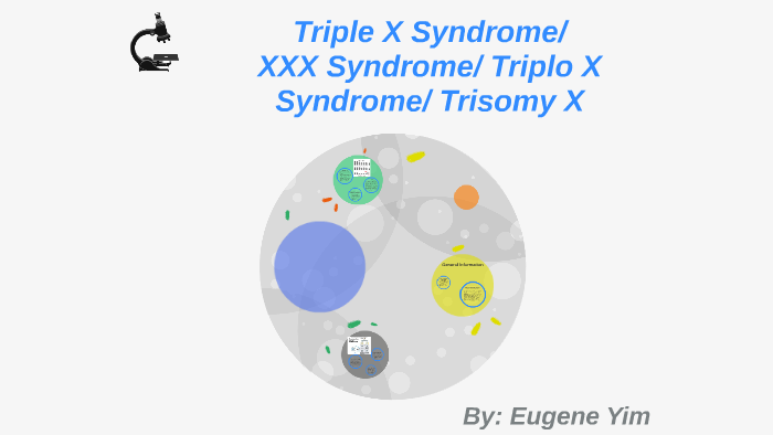 Triple X Syndrome/XXX Syndrome/ Triplo X Syndrome/ Trisomy X by Eugene ...