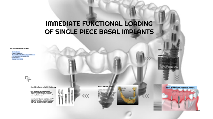 EVALUATION OF IMMEDIATE FUNCTIONAL LOADING IN SINGLE PIECE BASAL IMPLANTS by Akshay Thakur on Prezi