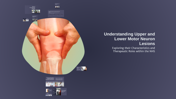 Understanding Upper and Lower Motor Neuron Lesions by Freeda Josephine ...