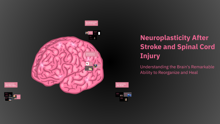 Neuroplasticity After Stroke and Spinal Cord Injury by majid alagraa on ...