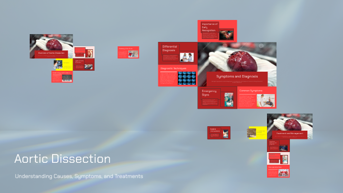 Aortic Dissection by Solehin Mamat on Prezi